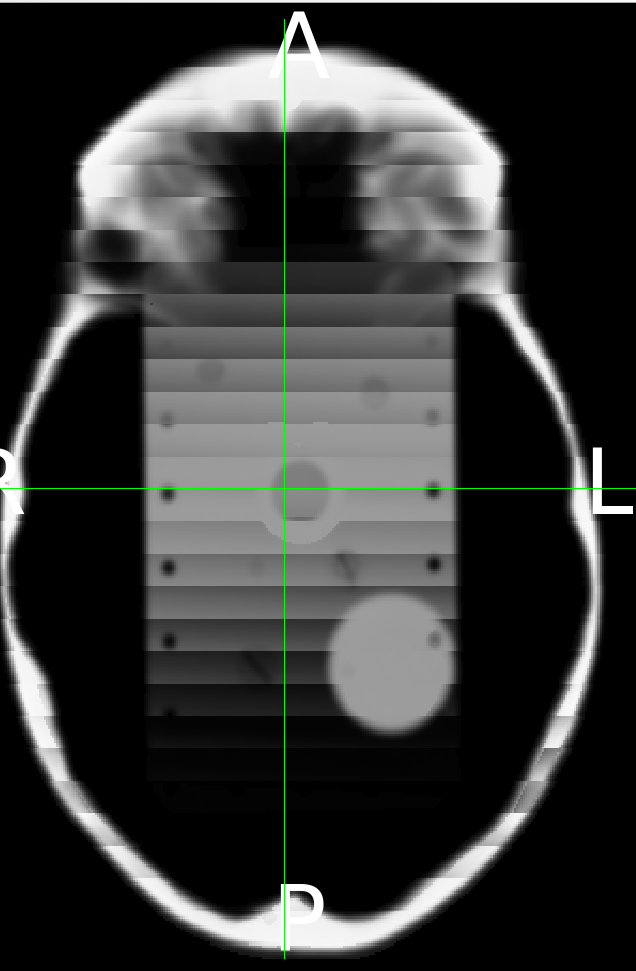 zooming in image space / viewport size · Issue #415 · niivue/niivue · GitHub