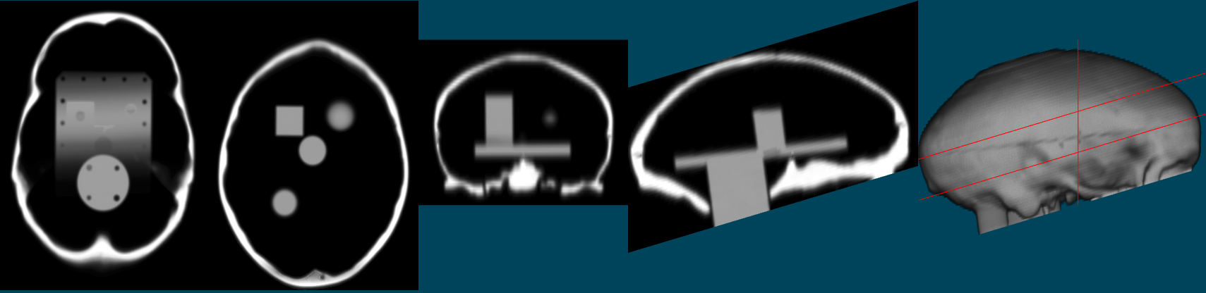 zooming in image space / viewport size · Issue #415 · niivue/niivue ...