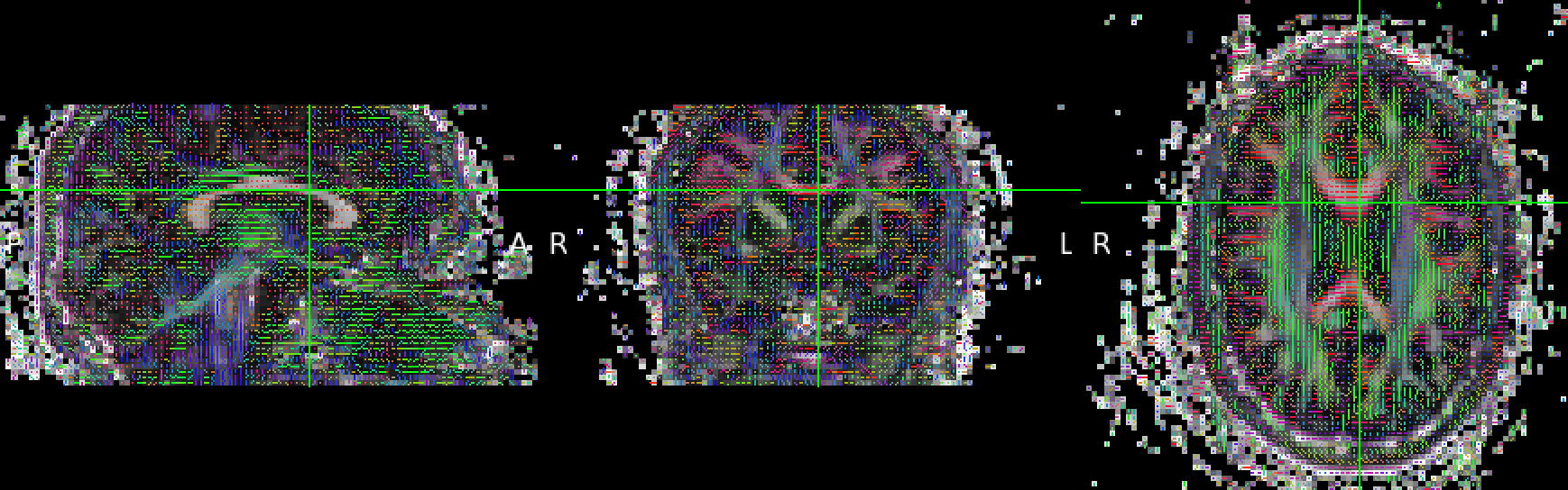 Are B Vectors Wrong Unless Row Order Is Preserved · Issue 643 · Rordenlabdcm2niix · Github
