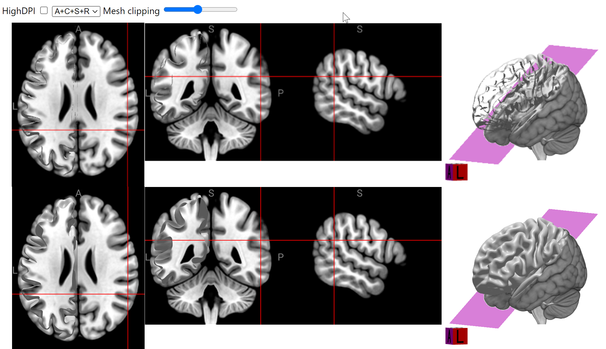 Experimental SliceMM breaks syncWith · Issue #440 · niivue/niivue · GitHub