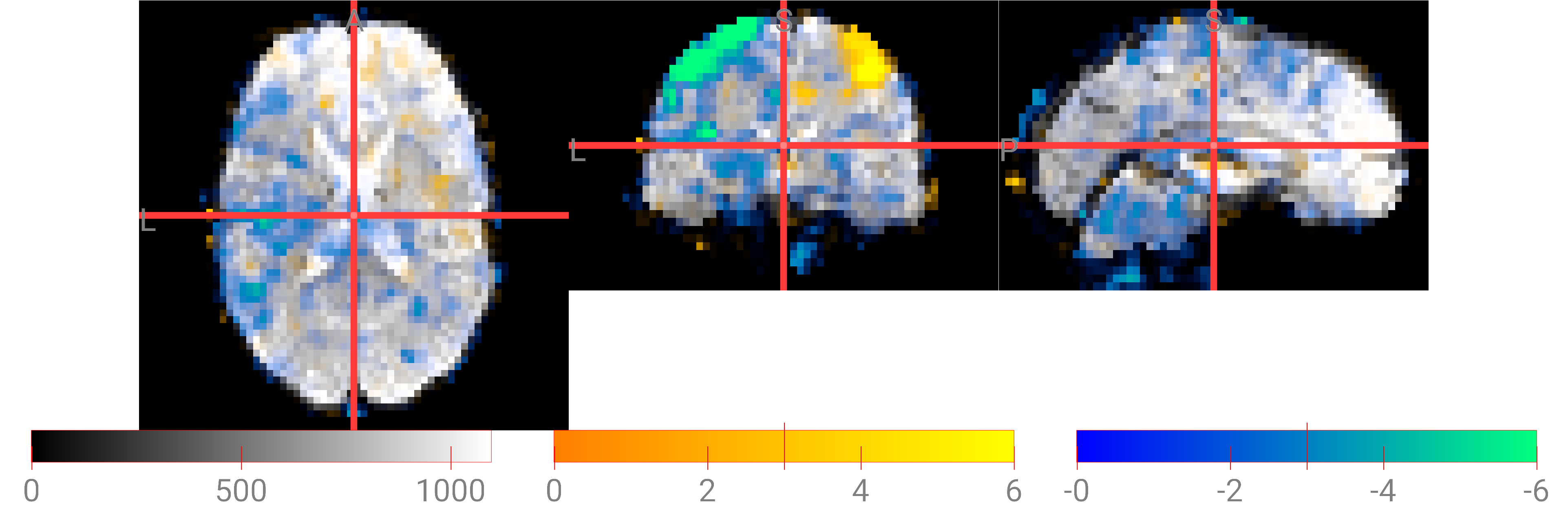 thresholding options: transparent (or "alpha") thresholding, and boxing · Issue #435 · niivue ...