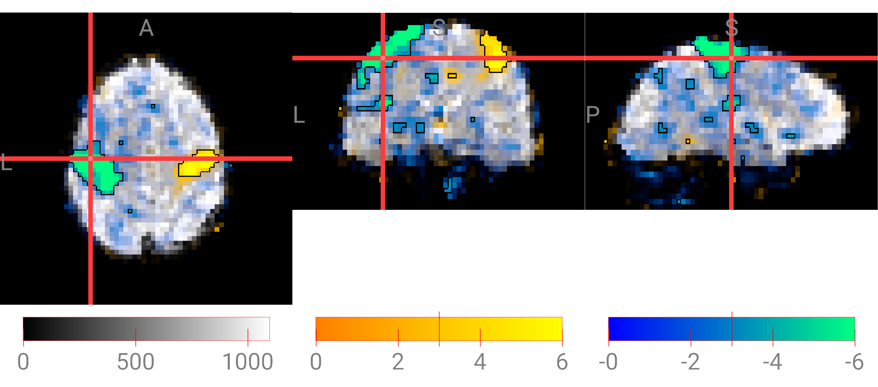 thresholding options: transparent (or "alpha") thresholding, and boxing · Issue #435 · niivue ...