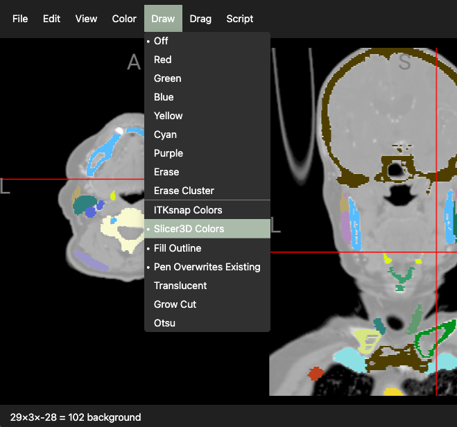 Drawing color mappings · Issue #466 · niivue/niivue · GitHub