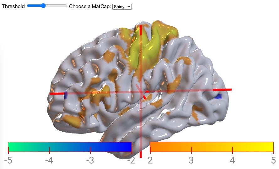 Add Matcap Effects · Issue #477 · niivue/niivue · GitHub