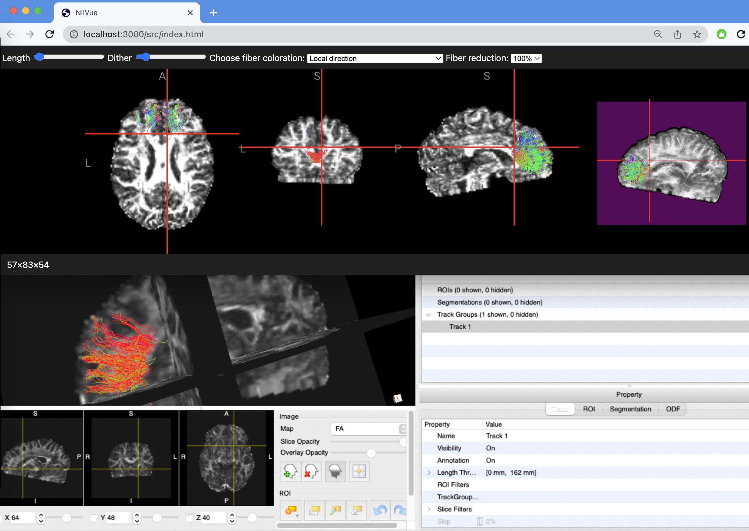 Alignment between trk and nifti volume · Issue #498 · niivue/niivue · GitHub