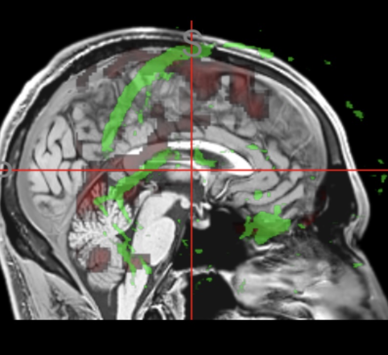 Only 2 gz files can be displayed when the latest version 32 is loaded ...