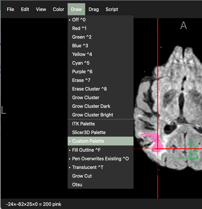 Change Label Color · Issue #575 · niivue/niivue · GitHub