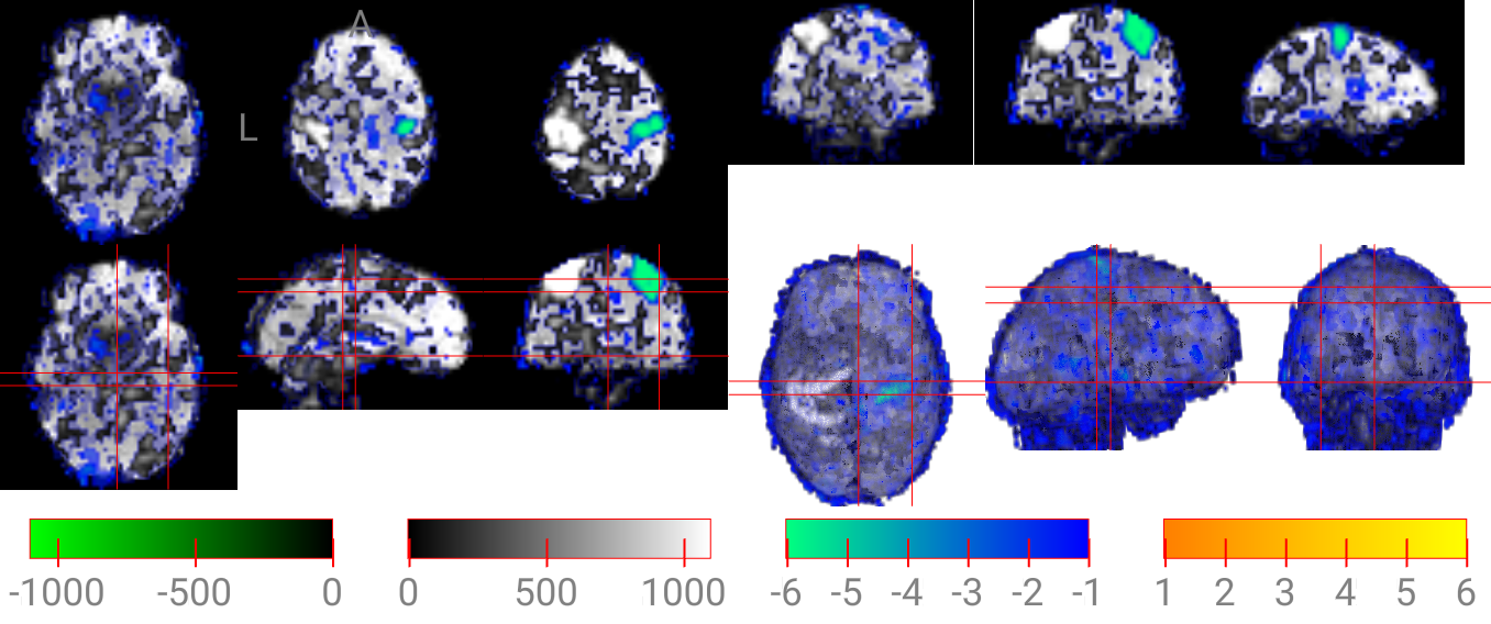 Artifact if colorMapNegative applied to volume that is not top layer ...