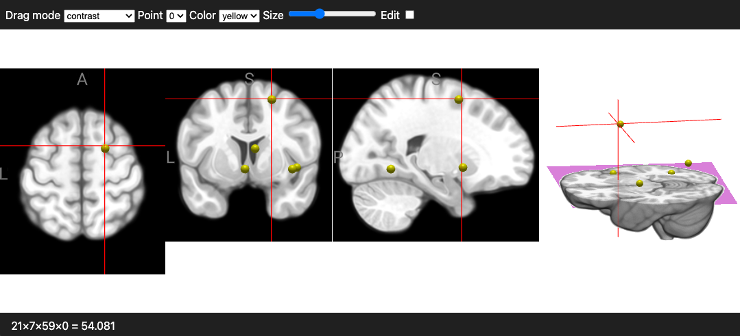 Support FreeSurfer Point Sets · Issue #600 · niivue/niivue · GitHub