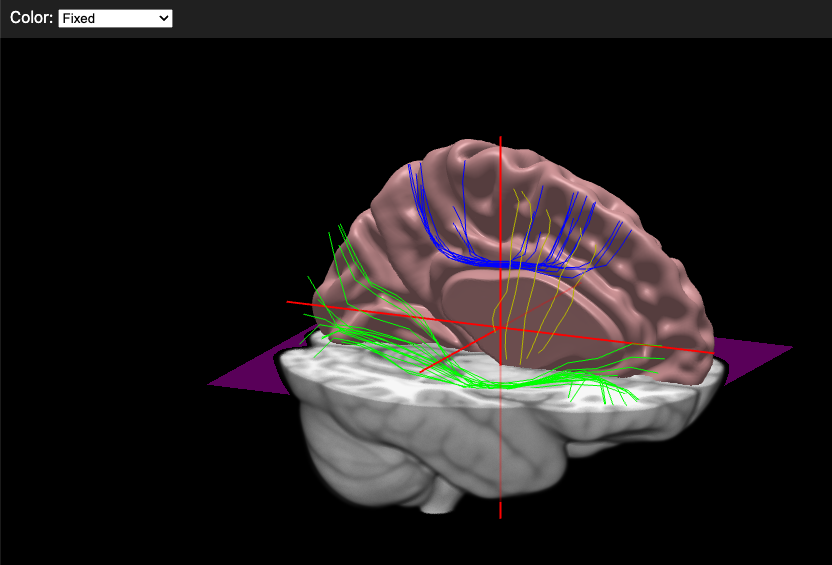 Setting color for .trk files · Issue #597 · niivue/niivue · GitHub