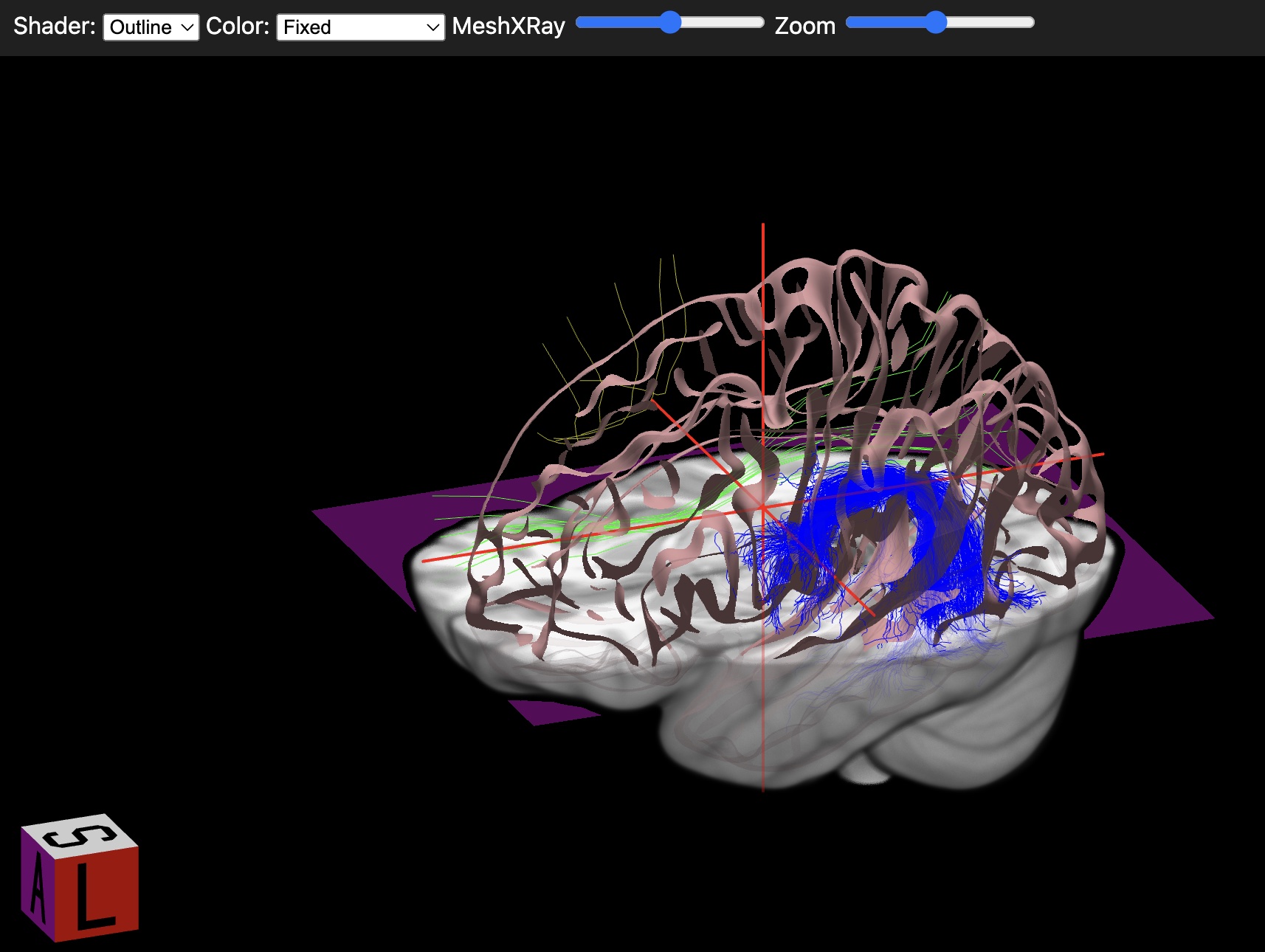 Way of telling if .trk file is empty/has no streamlines · Issue #607 · niivue/niivue · GitHub