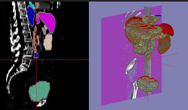 loadDrawingFromUrl vs loadVolumes · Issue #616 · niivue/niivue · GitHub