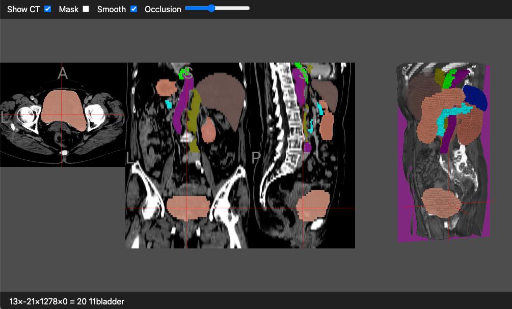 loadDrawingFromUrl vs loadVolumes · Issue #616 · niivue/niivue · GitHub