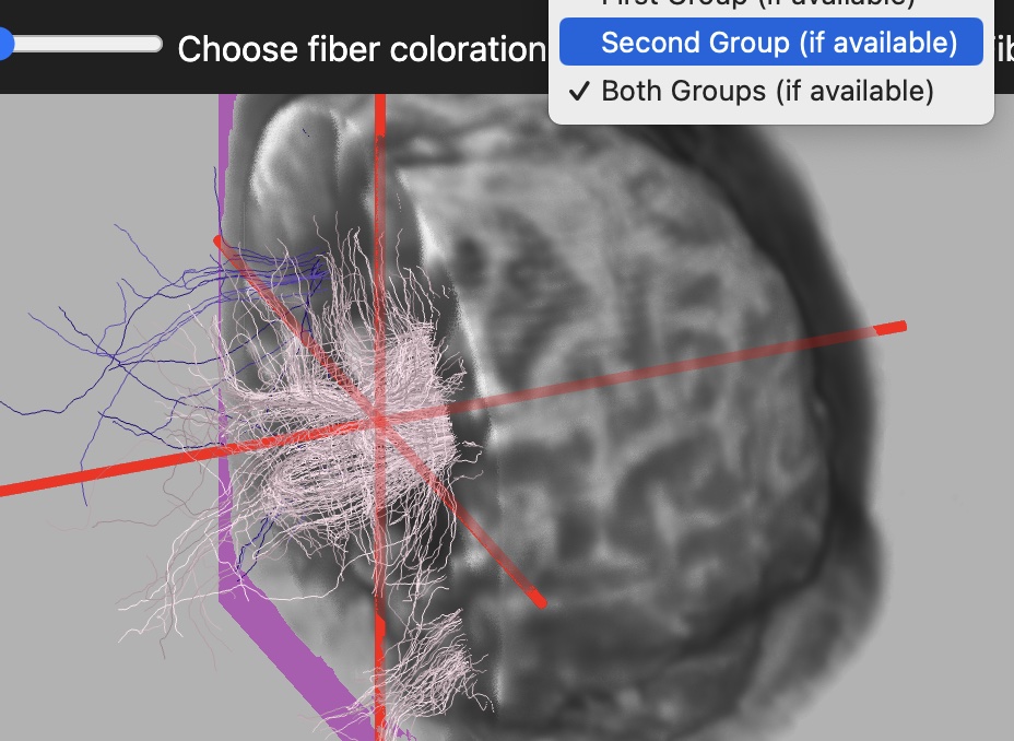 Support for TRX groups · Issue #657 · niivue/niivue · GitHub
