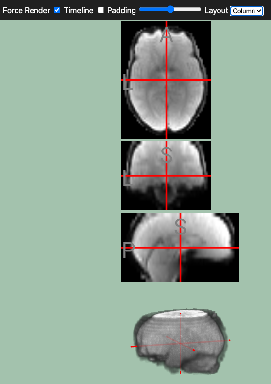 higher customization possibilities for the interface layout · Issue #702 · niivue/niivue · GitHub