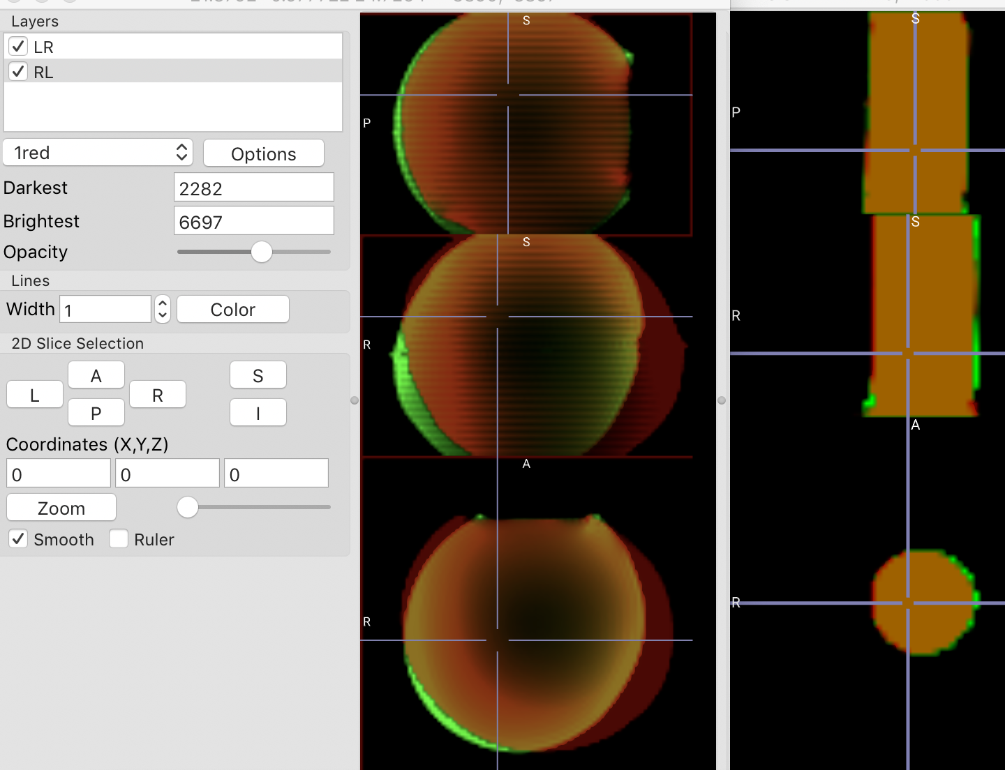 Unable to extract PhaseEncodingDirection when dcm2niix converts to UIH ...