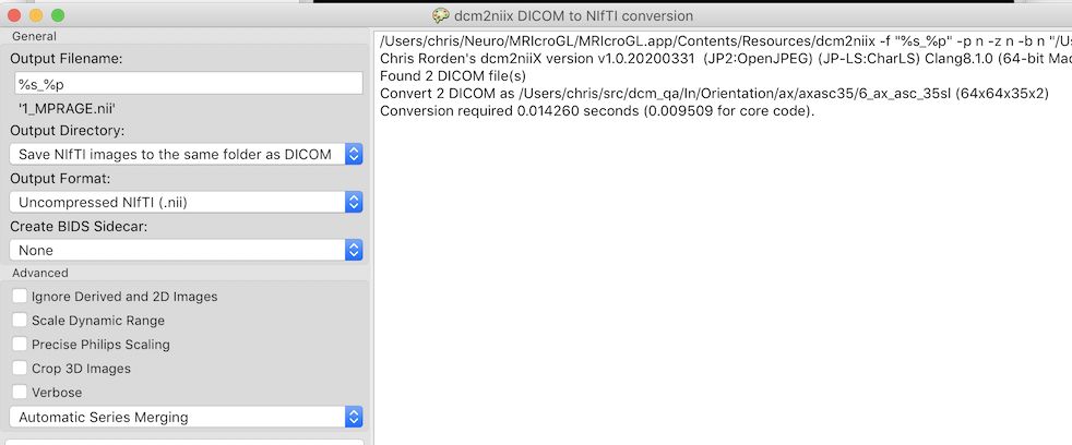 CT nrrd fails · Issue #436 · rordenlab/dcm2niix · GitHub