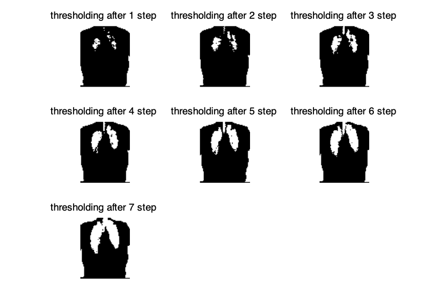GitHub - HesamoddinHosseini/Automate_Lung_Segmentation_in_Digitized_Posteroanterior_Chest ...