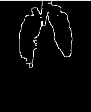 GitHub - HesamoddinHosseini/Automate_Lung_Segmentation_in_Digitized_Posteroanterior_Chest ...