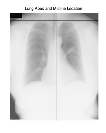 GitHub - HesamoddinHosseini/Automate_Lung_Segmentation_in_Digitized_Posteroanterior_Chest ...