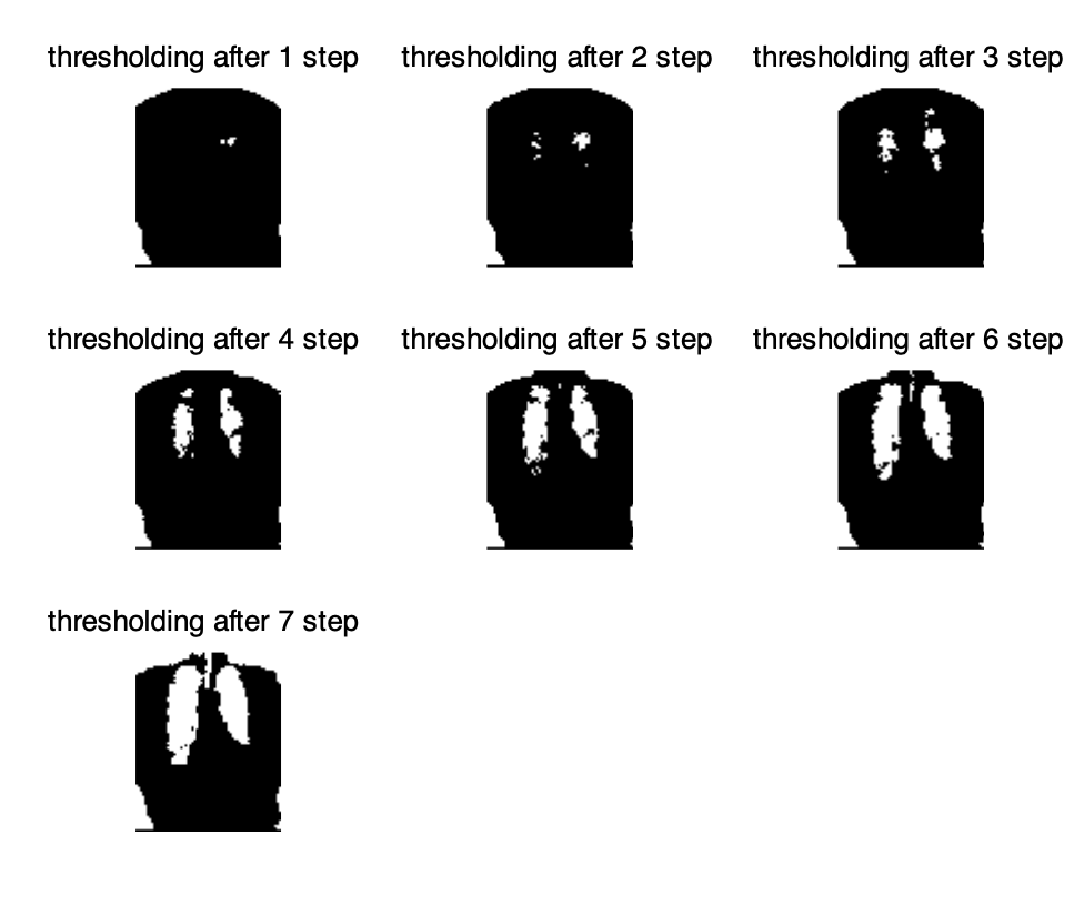 GitHub - HesamoddinHosseini/Automate_Lung_Segmentation_in_Digitized_Posteroanterior_Chest ...