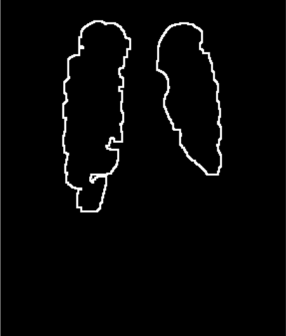 GitHub - HesamoddinHosseini/Automate_Lung_Segmentation_in_Digitized_Posteroanterior_Chest ...
