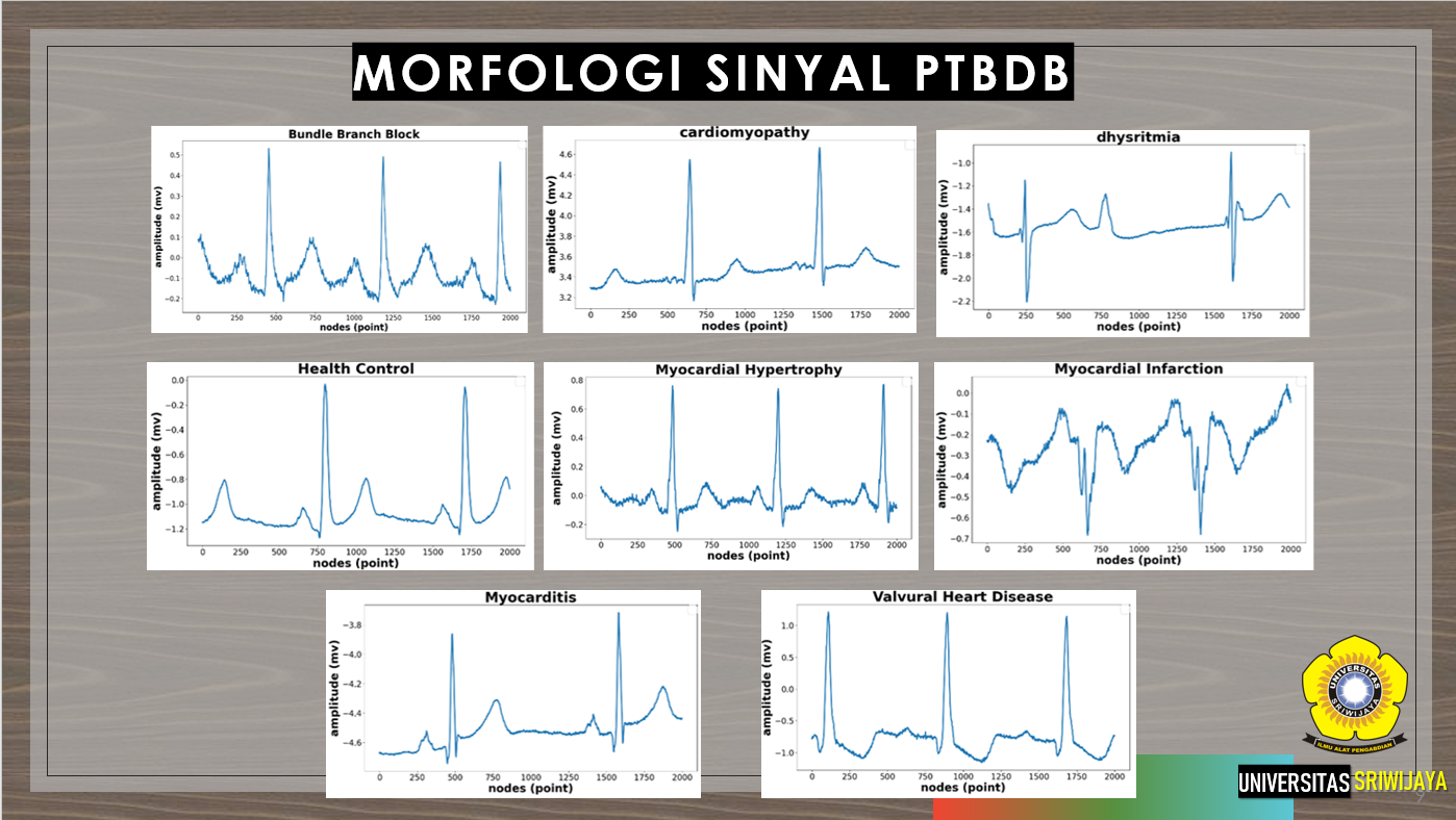 GitHub - ahmadfansyuri/HeartClassification_Thesis