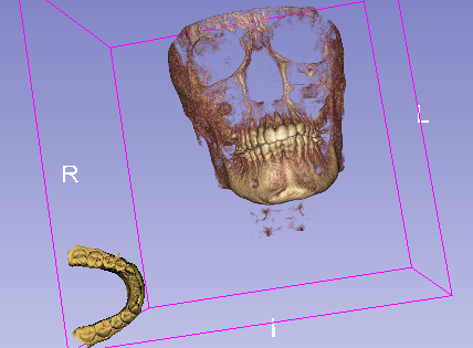 Transformation matrix (affine_matrix_from_points) · Issue #57 · matthew-brett/transforms3d · GitHub
