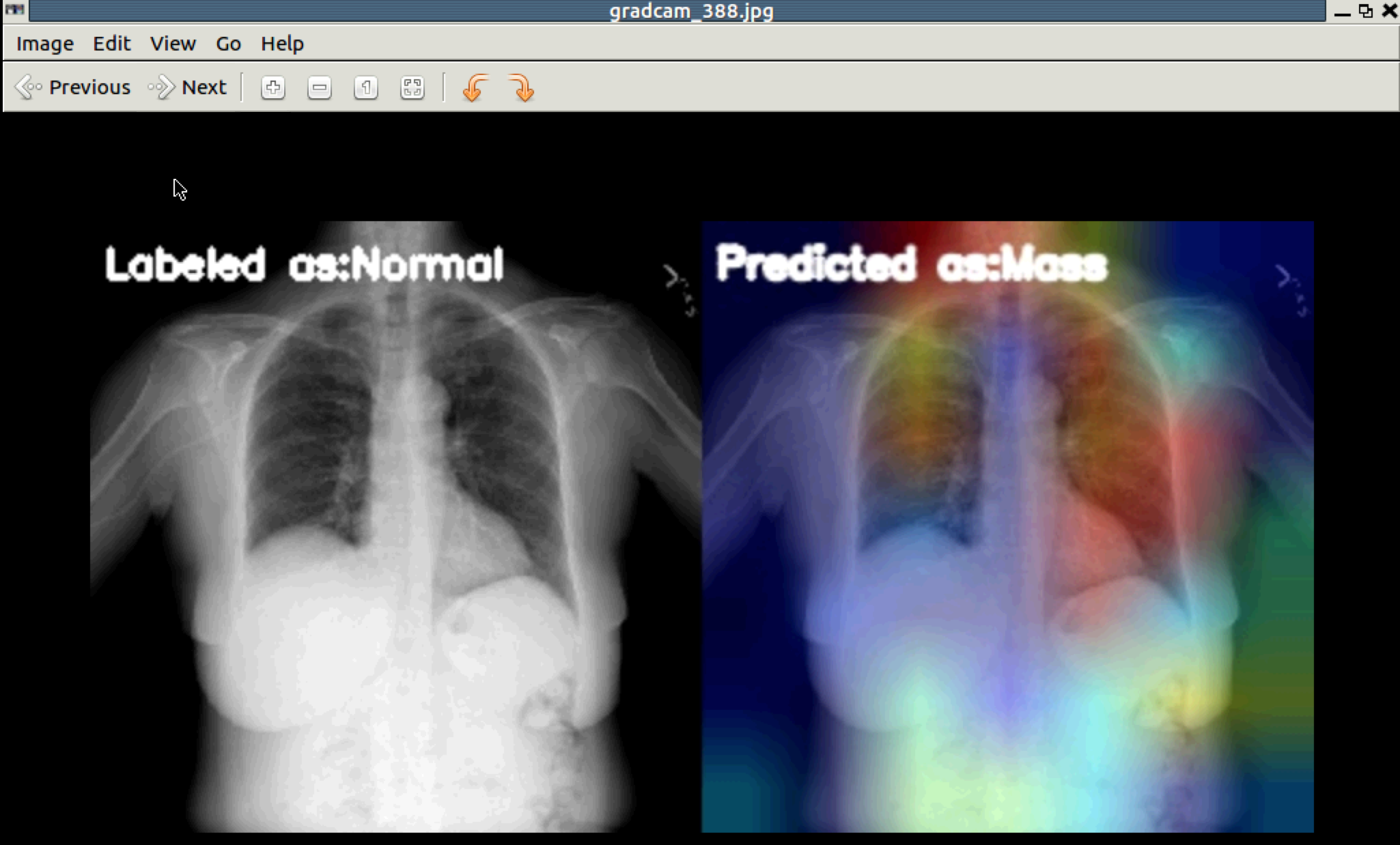 Prediction Accuracy seem to be not accurate · Issue #22 · brucechou1983/CheXNet-Keras · GitHub