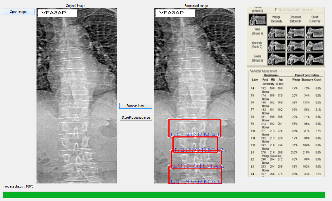GitHub - tayyabafaysal/SURF-for-image-processing: A desktop-application ...