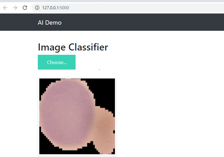 GitHub - SaiDharanesh/Malaria-Detection