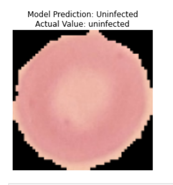 GitHub - Guna940/Deep-Neural-Network-for-Malaria-Infected-Cell-Recognition