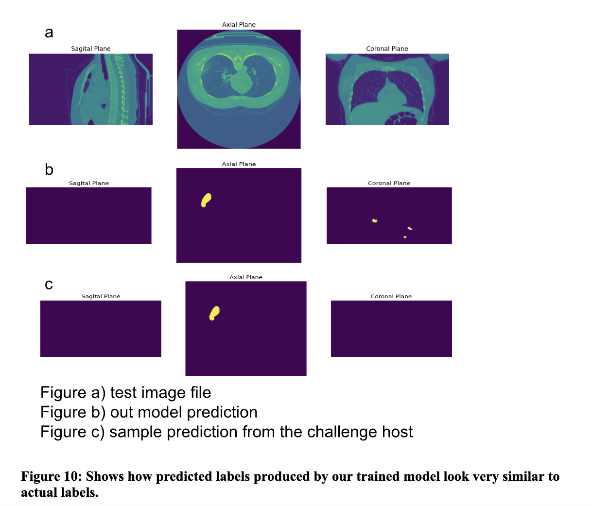 GitHub - rutasnim/COVID-19_Lung-_Lesion_Seg: nnU-Net network on COVID ...
