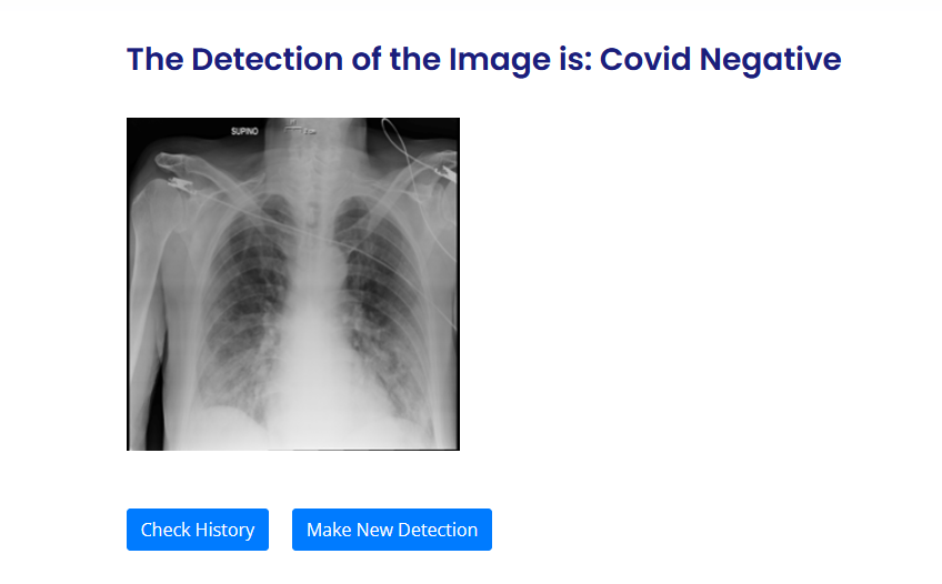 Github Ai Watcher Covid Detection