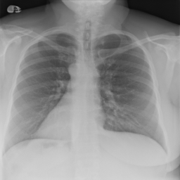 GitHub - shaoyanpan/2D-Medical-Denoising-Diffusion-Probabilistic-Model ...