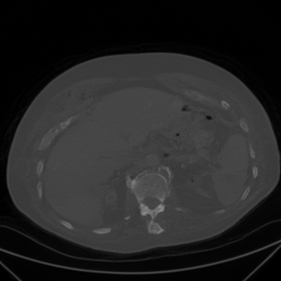 GitHub - shaoyanpan/2D-Medical-Denoising-Diffusion-Probabilistic-Model ...