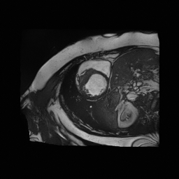 GitHub - shaoyanpan/2D-Medical-Denoising-Diffusion-Probabilistic-Model ...