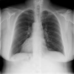 GitHub - shaoyanpan/2D-Medical-Denoising-Diffusion-Probabilistic-Model ...