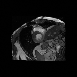 GitHub - shaoyanpan/2D-Medical-Denoising-Diffusion-Probabilistic-Model ...
