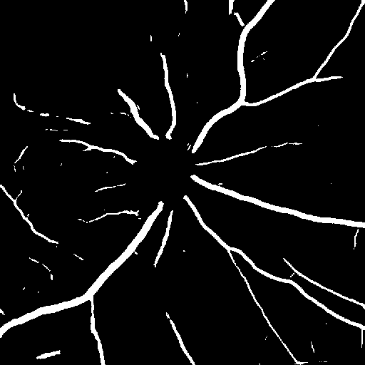 GitHub - foyie/RetinaNet