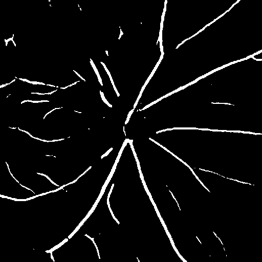 GitHub - foyie/RetinaNet