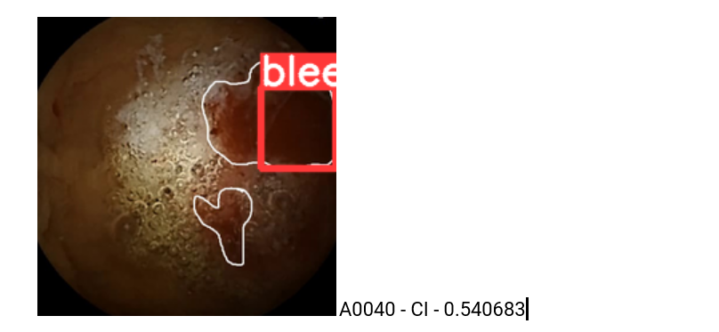 Github Stonerrb Misahub Classification And Detection Of Bleeding And Non Bleeding Edges On