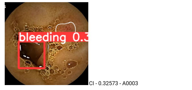Github Stonerrb Misahub Classification And Detection Of Bleeding And Non Bleeding Edges On