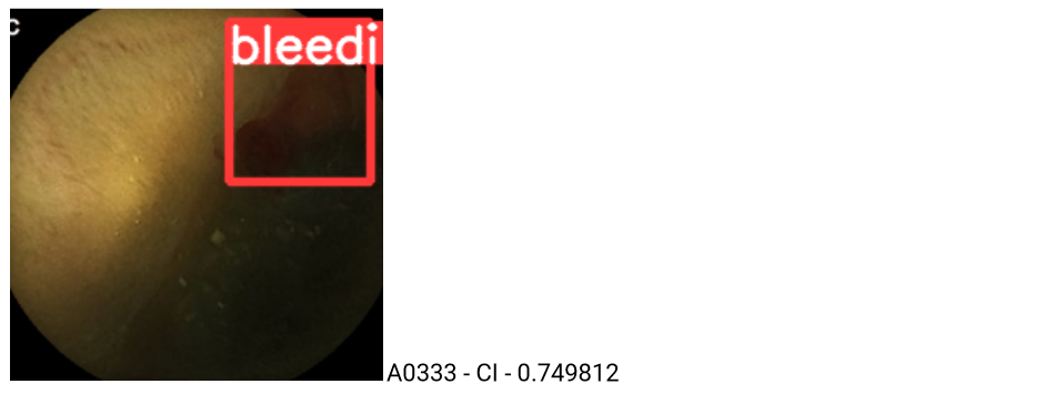 Github Stonerrb Misahub Classification And Detection Of Bleeding And Non Bleeding Edges On