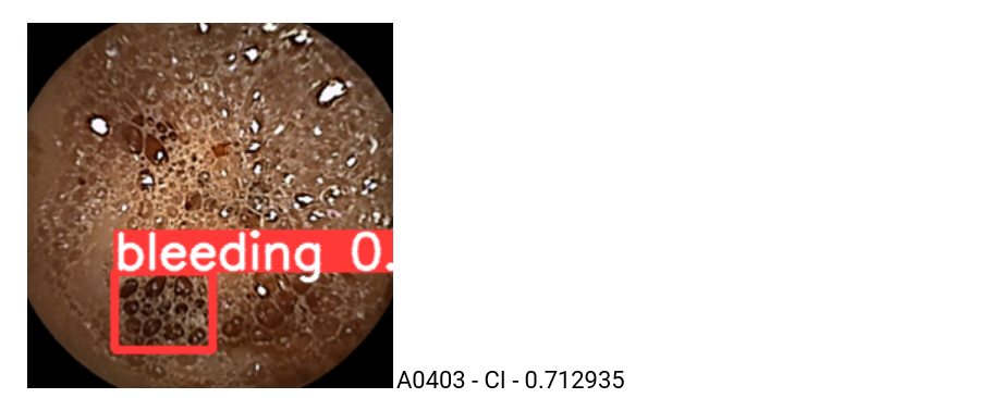 Github Stonerrb Misahub Classification And Detection Of Bleeding And Non Bleeding Edges On
