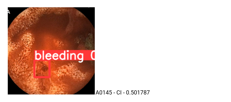 Github Stonerrb Misahub Classification And Detection Of Bleeding And Non Bleeding Edges On