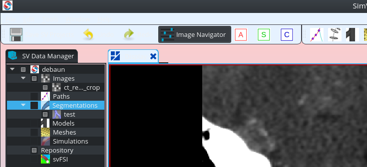 simvascular colorscheme does not work with dark theme · Issue #367 · SimVascular/SimVascular ...
