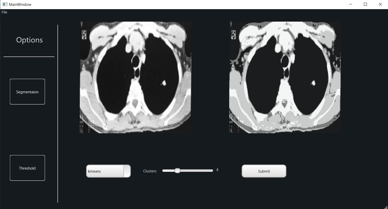 GitHub - ahmeddemaad/Image_Segmentation