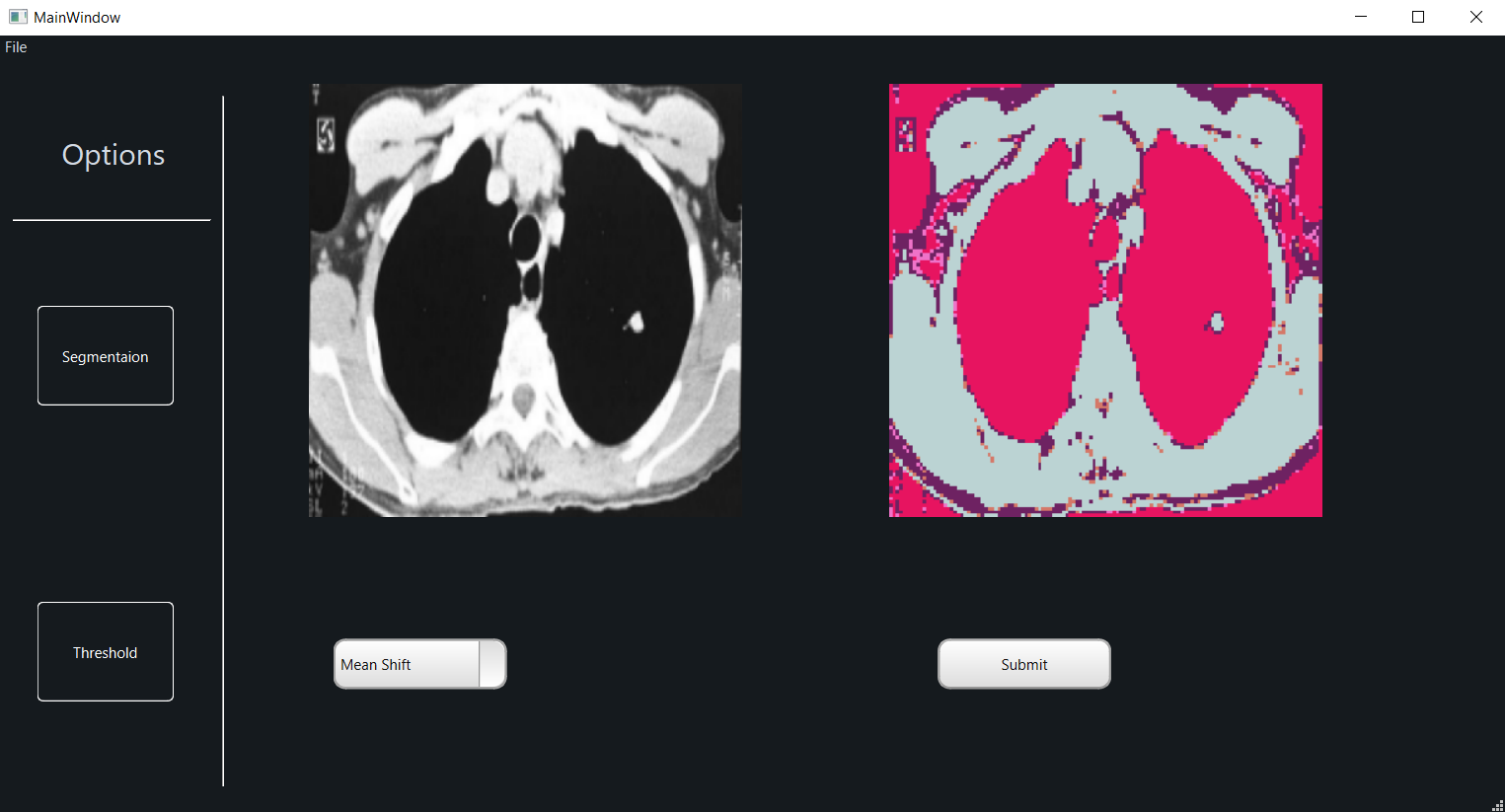 GitHub - ahmeddemaad/Image_Segmentation
