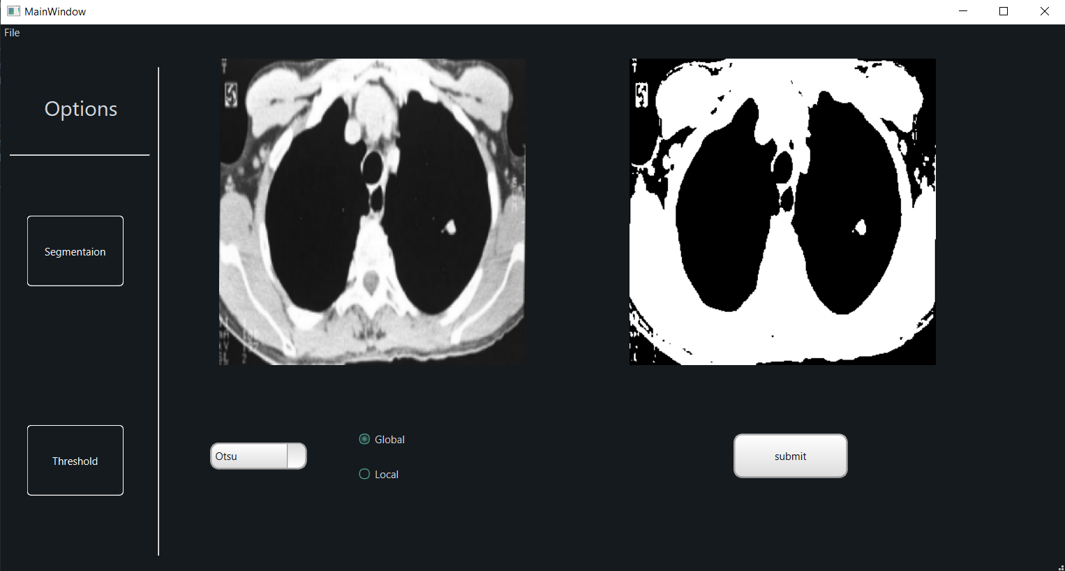 GitHub - MyProjectsProgress/Image_Segmentation_and_Threhsolding: Image segmentation and ...